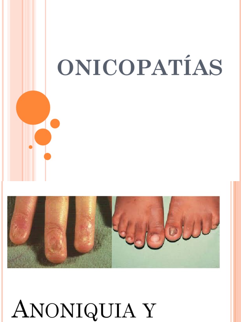 Onicopatias 1 | PDF | Clavo (anatomía) | Medicina CLINICA