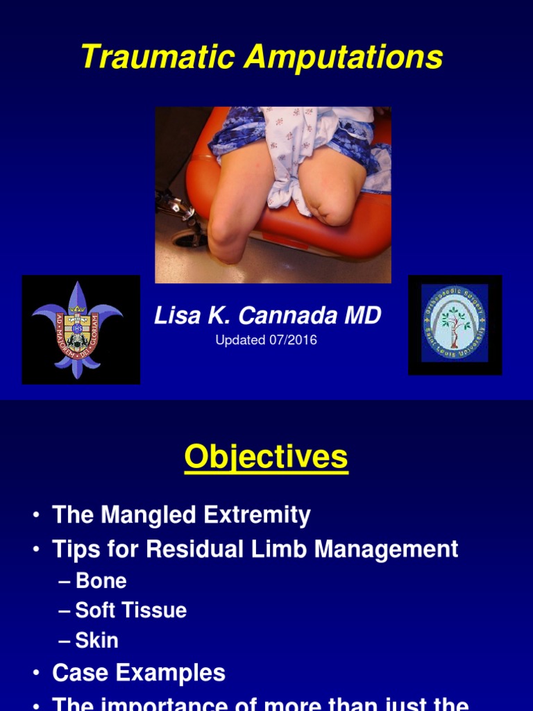 Traumatic Amputations: Lisa K. Cannada MD | PDF | Amputation | Wound