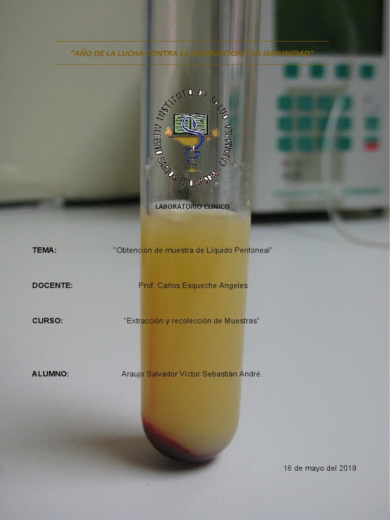 Obtención de Muestra de Líquido Peritoneal | Peritoneo | Abdomen