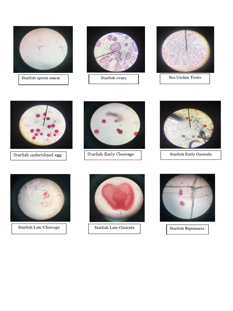 Starfish Sperm Smear Starfish Ovary Sea Urchin Testis | PDF
