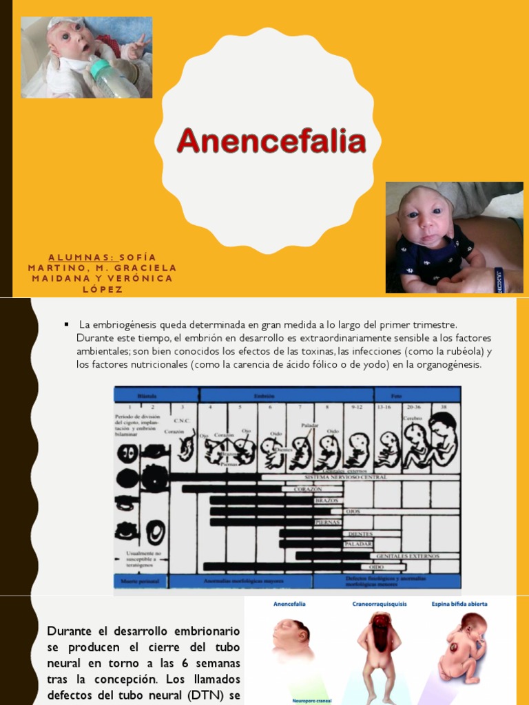 Desarrollo embrionario y defectos del tubo neural: Anencefalia ...