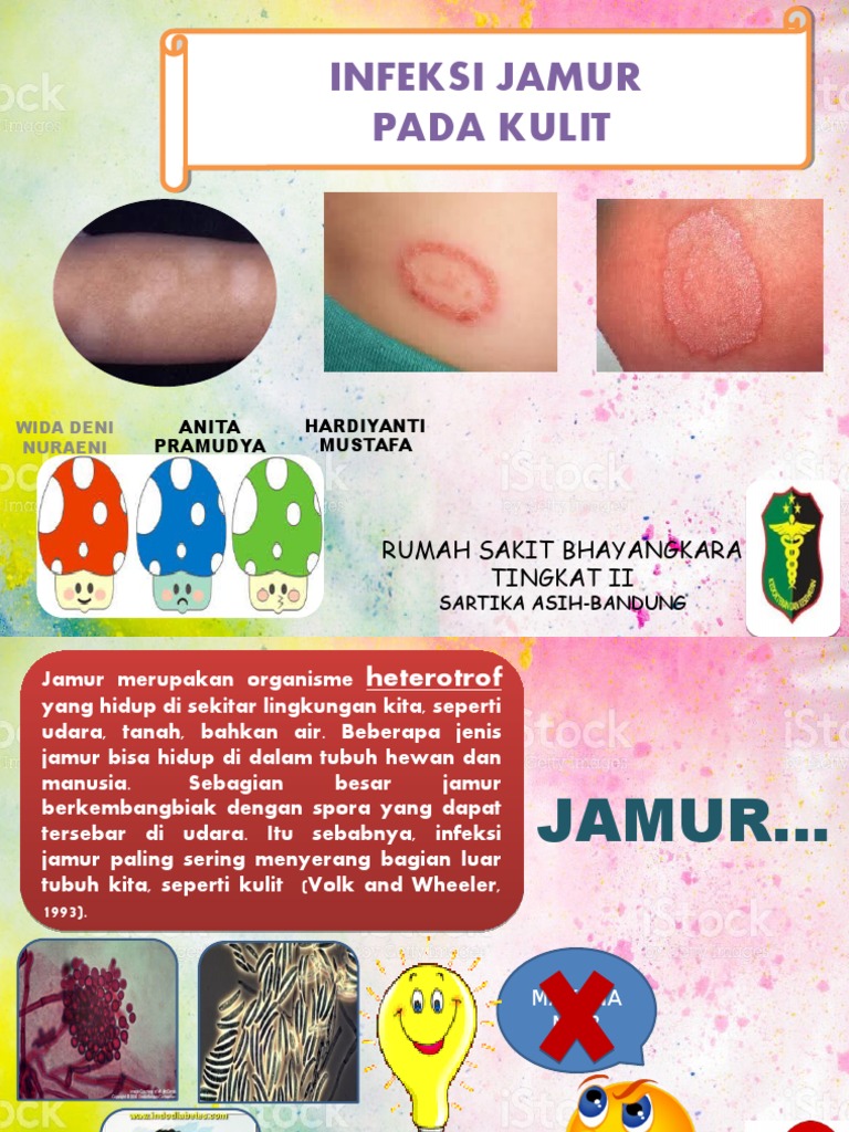 Infeksi Jamur Pada Kulit | PDF