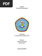 Malunion, Nonunion, dan Delayed Union | PDF