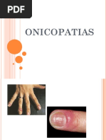 Polioniquia: Causas y Tratamiento | PDF