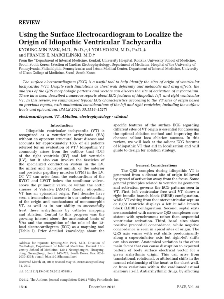 Using The Surface Electrocardiogram To Localization of Idiopathic ...