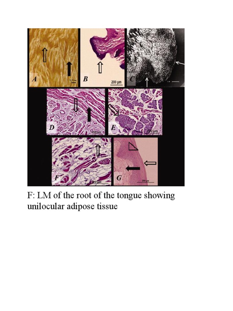 F: LM of The Root of The Tongue Showing Unilocular Adipose Tissue | PDF