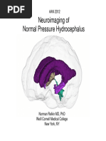 The Evans' Index Revisited | PDF | Sensitivity And Specificity | Neurology