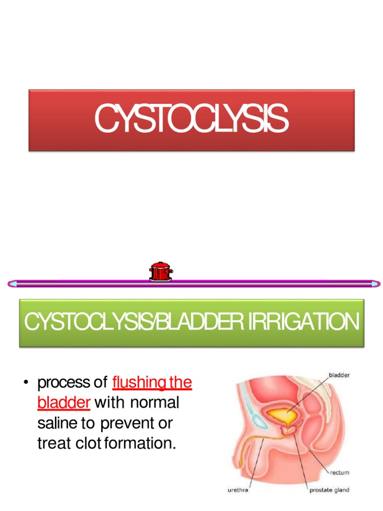 Cystoclysis | PDF | Urinary Tract Infection | Catheter