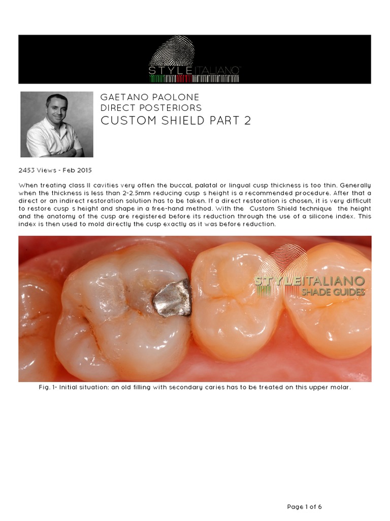 Custom Shield Technique PDF | PDF | Dental Composite | Mouth
