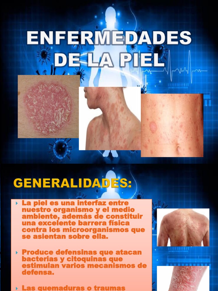 Enfermedades de La Piel | PDF