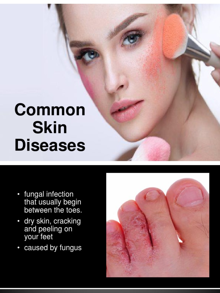 Common and Rare Skin Diseases Guide | PDF | Skin | Cutaneous Conditions