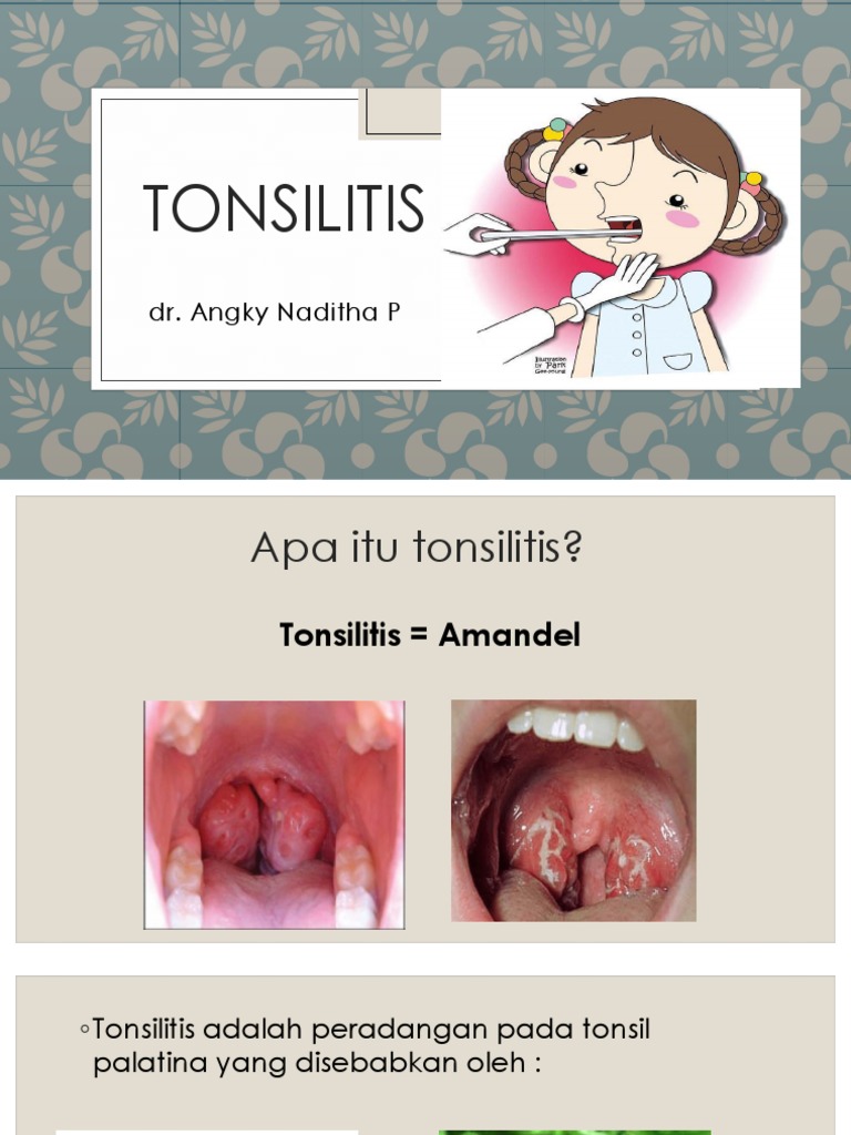 Tonsil | PDF | Kesehatan Holistik | Sains & Matematika
