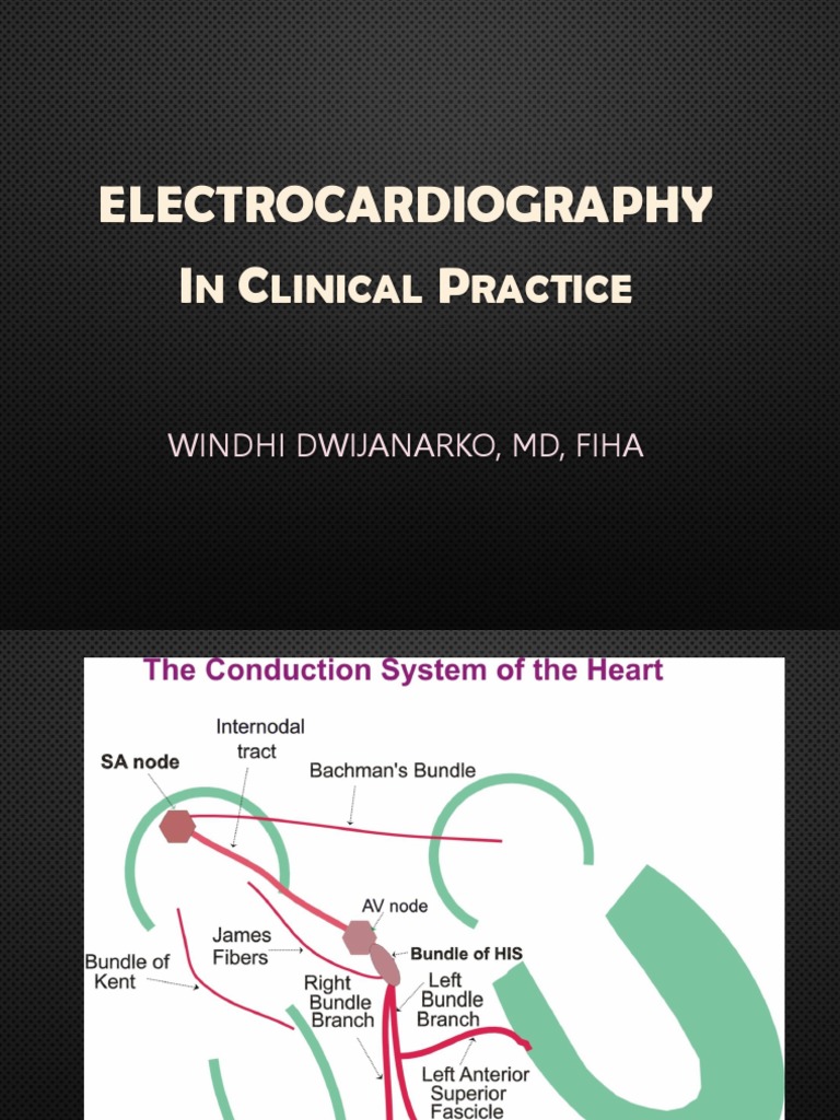 ECG Interpretation in Clinical Practice | PDF | Electrocardiography ...