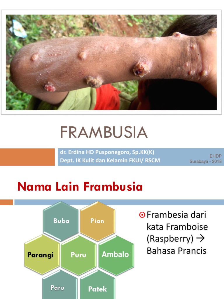 Terapi dan Diagnosis Frambusia | PDF