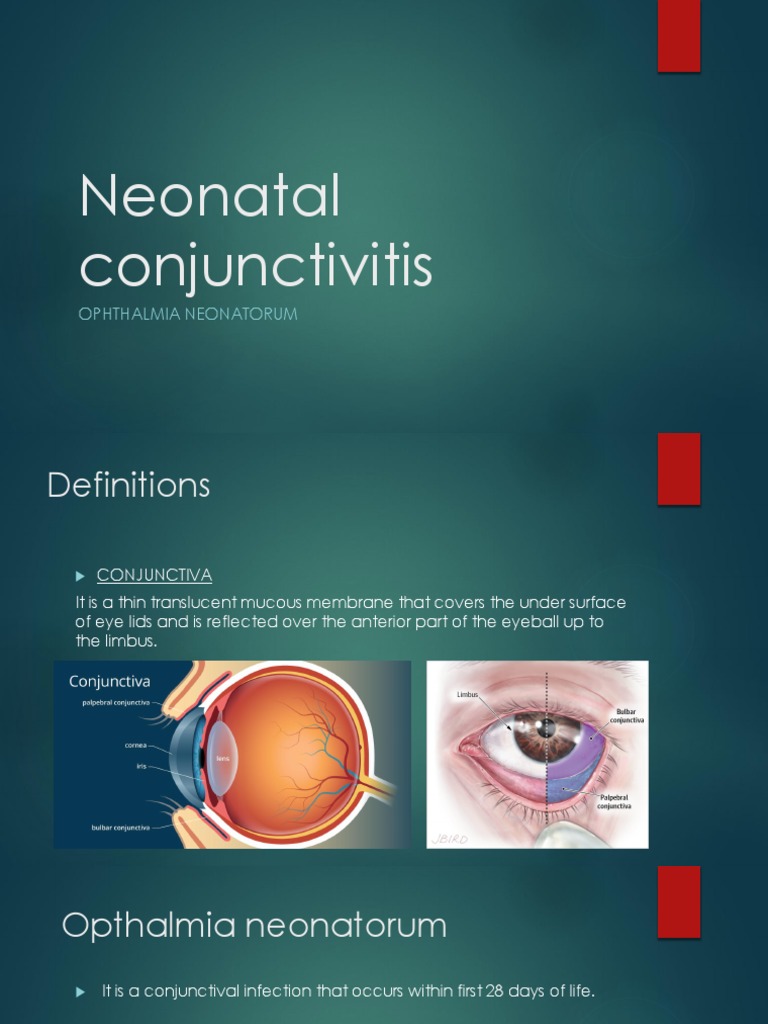 Neonatal Conjunctivitis | PDF | Public Health | Rtt
