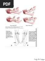 Pemeriksaan Neurologis LBP: Tes Lasegue & Lainnya | PDF