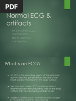 Rhythm | PDF | Cardiac Arrhythmia | Electrocardiography