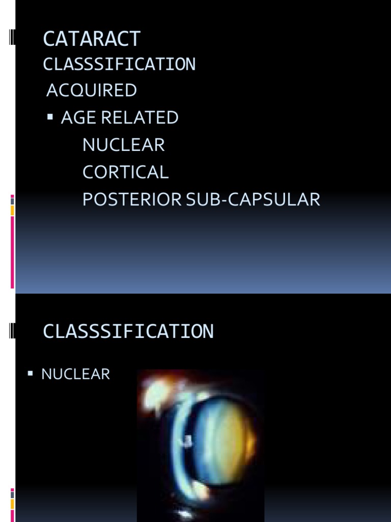 Cataract Classification and Surgery Overview | PDF | Cataract ...