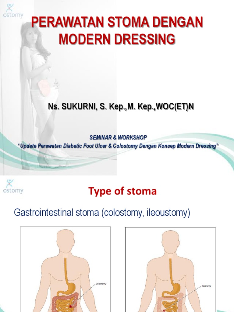 Panduan Lengkap Perawatan Stoma Modern | PDF