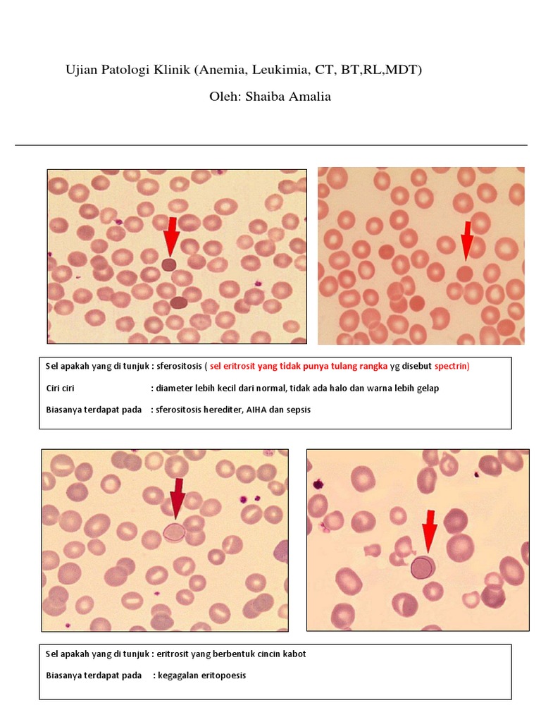 Bahan Ujian Patologi Klinik | PDF