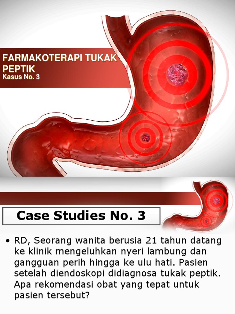 Terapi Tukak Peptik: Rekomendasi Obat dan Nonfarmakologi | PDF