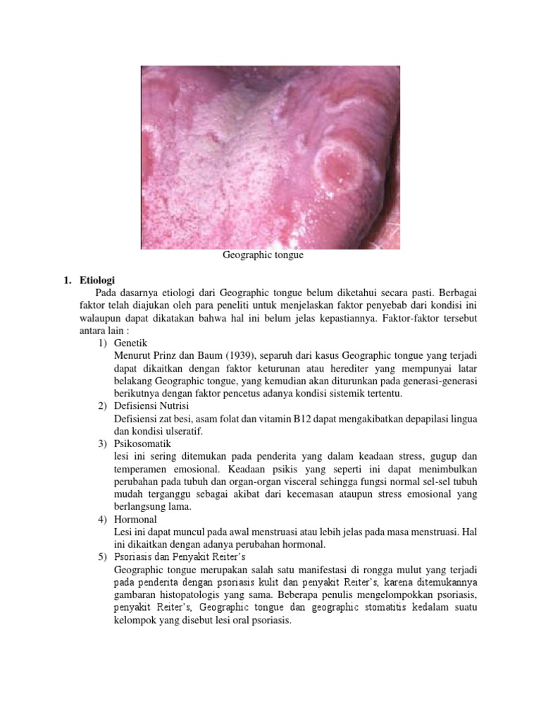 Geographic Tongue | PDF
