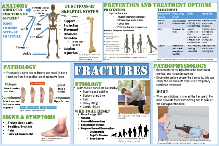 Presentation Poster | PDF | Bone | Surgical Specialties