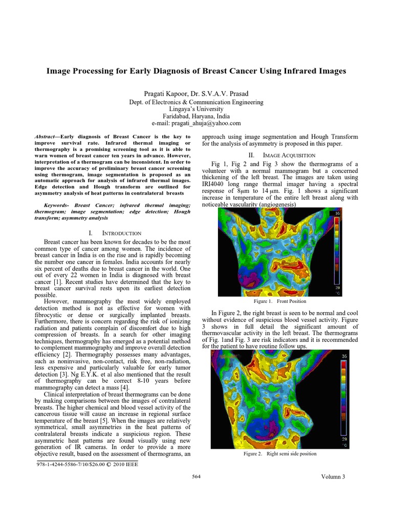 Automated Detection of Early-Stage Breast Cancer Using Infrared Thermal ...