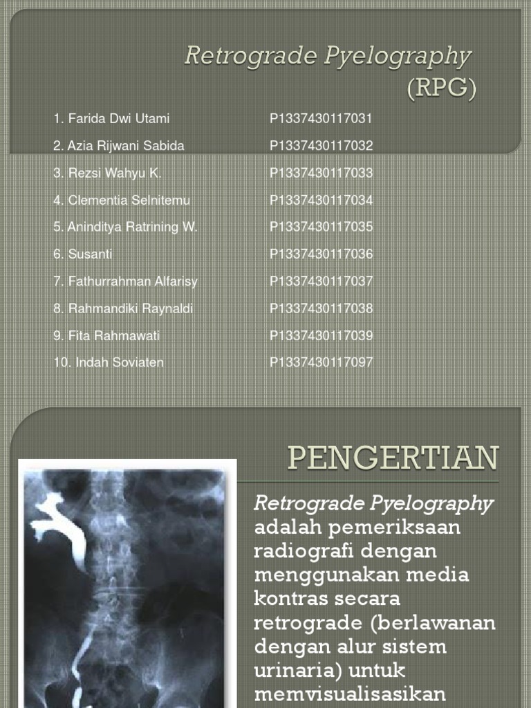 Retrograde Pyelography Fix | PDF