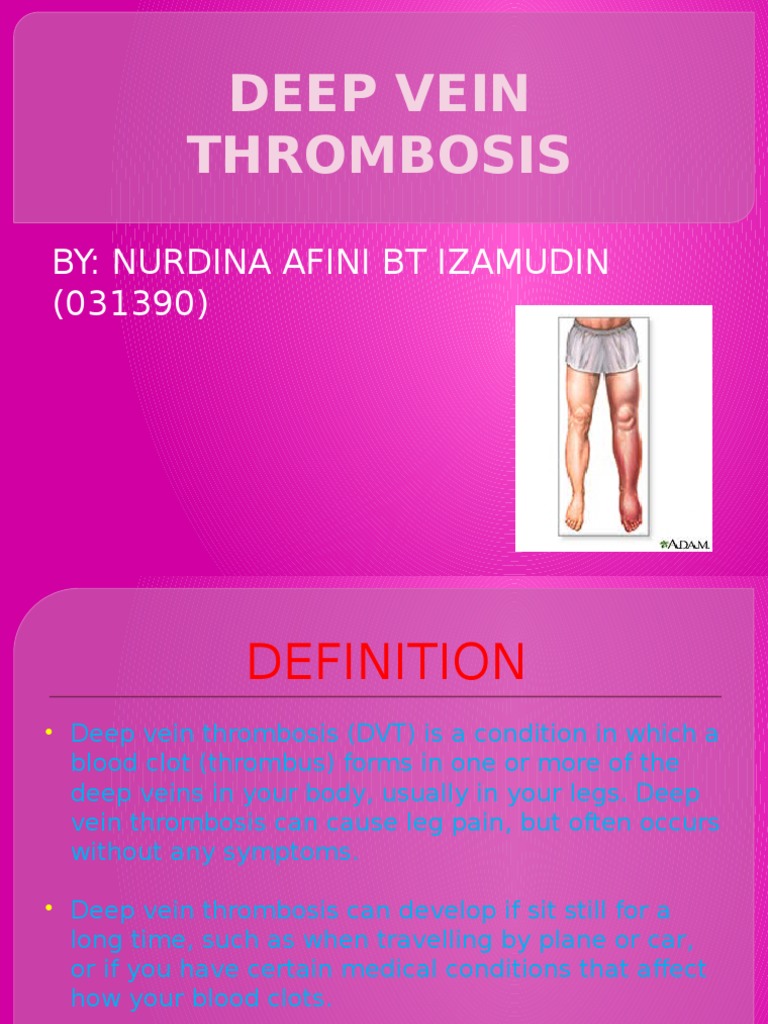 Deep Vein Thrombosis: A Comprehensive Overview of the Pathophysiology ...