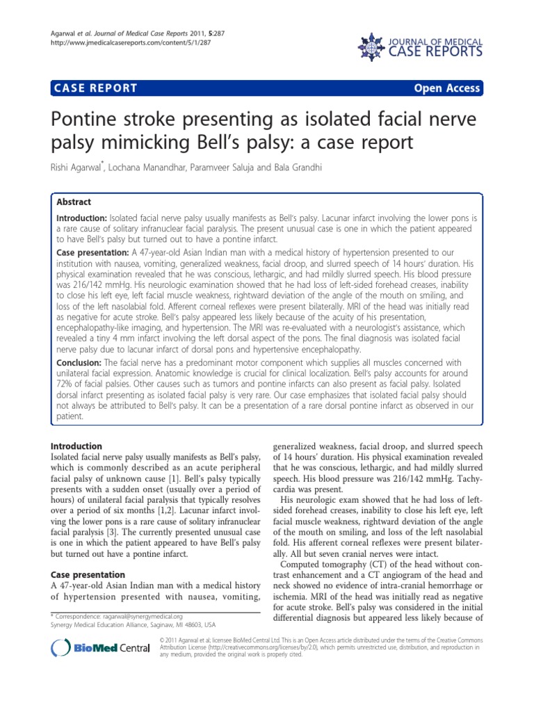 Bels Palsy | PDF | Stroke | Clinical Medicine