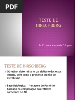 Teste de Hirschberg PDF | PDF