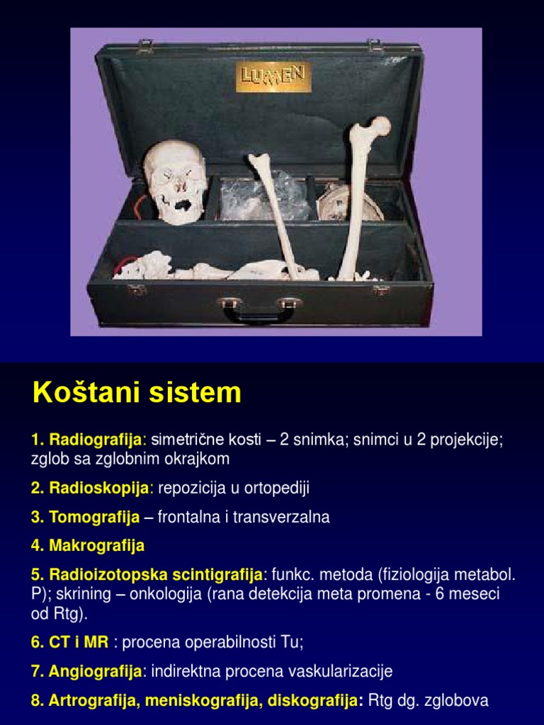Kosti | PDF