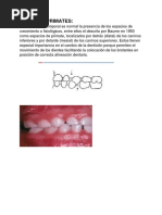 Existen 4 Tipos de Planos Terminales en La Dentición Primaria | PDF ...