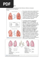 Bullas y Cavernas en Lesiones Pulmonares | PDF | Pulmón | Ct Scan