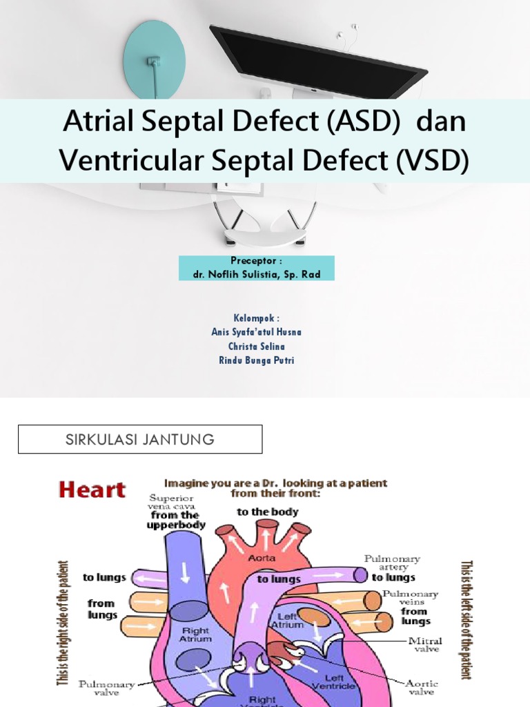 Atrial Septal Defect (ASD) Dan Ventricular Septal Defect (VSD ...