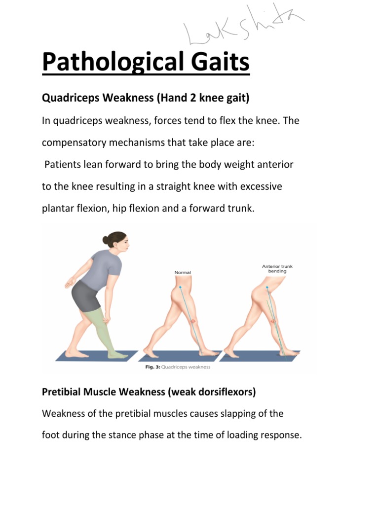 Pathological Gaits: Quadriceps Weakness (Hand 2 Knee Gait) | PDF ...