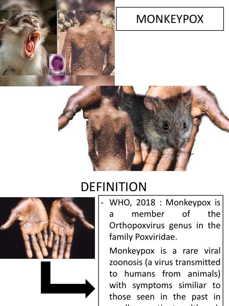 Monkeypox | PDF
