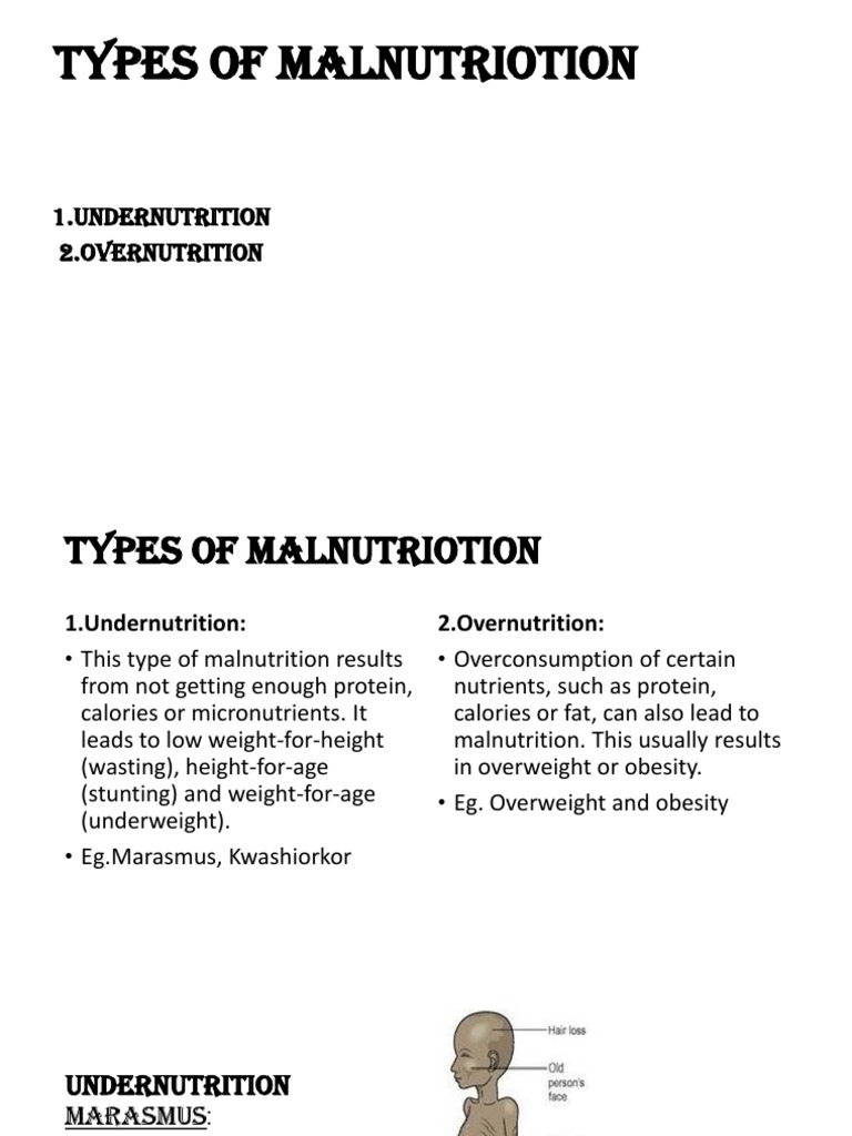 Types of Malnutrition: Undernutrition & Overnutrition | PDF