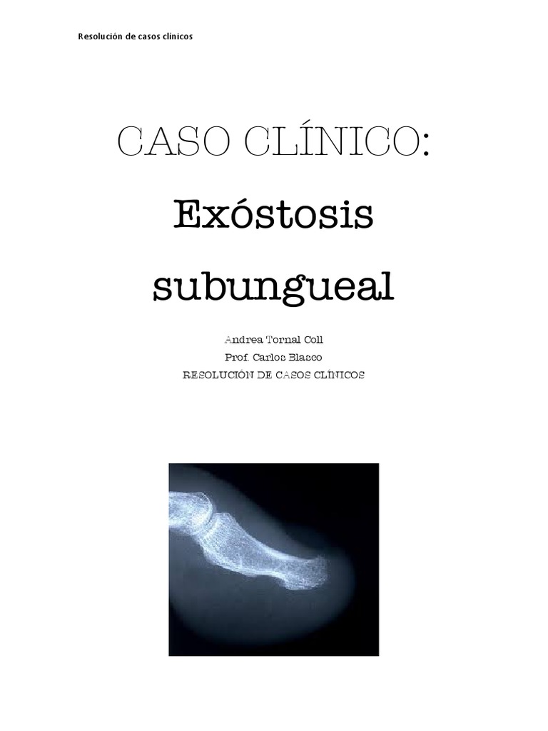 Exóstosis Subungueal: Caso Clínico | PDF | Clavo (anatomía) | Dedo del pie