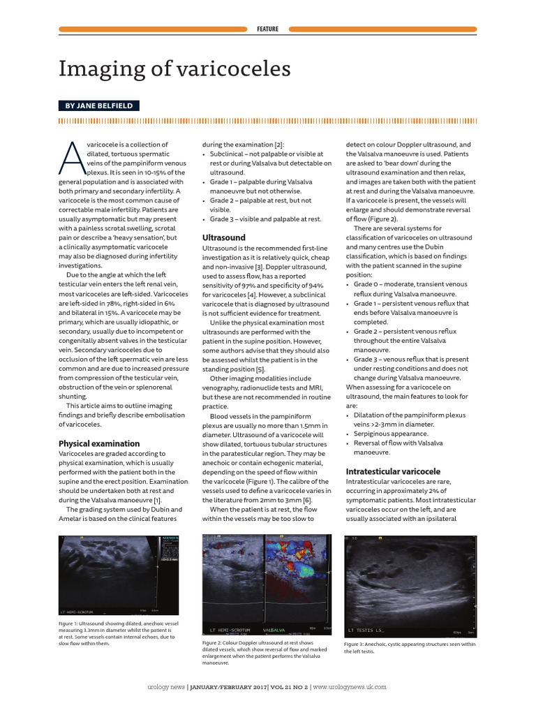 Imaging of Varicoceles: Ultrasound | Download Free PDF | Medical ...