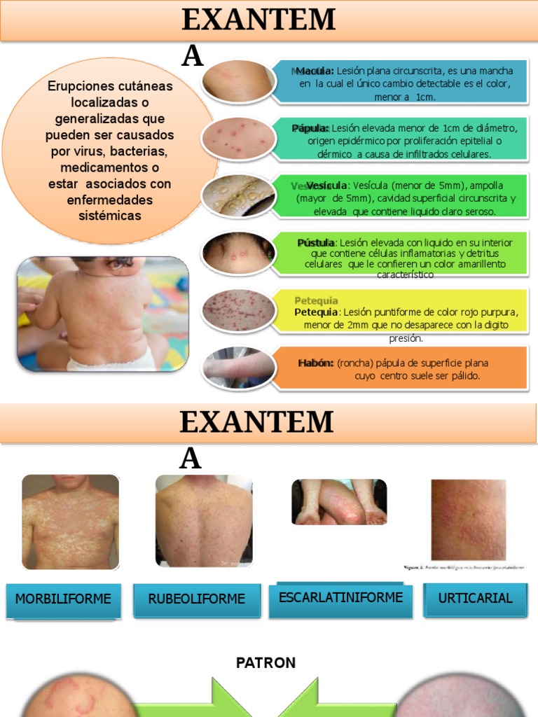 Exantemas | PDF | Sarampión | Microbiología