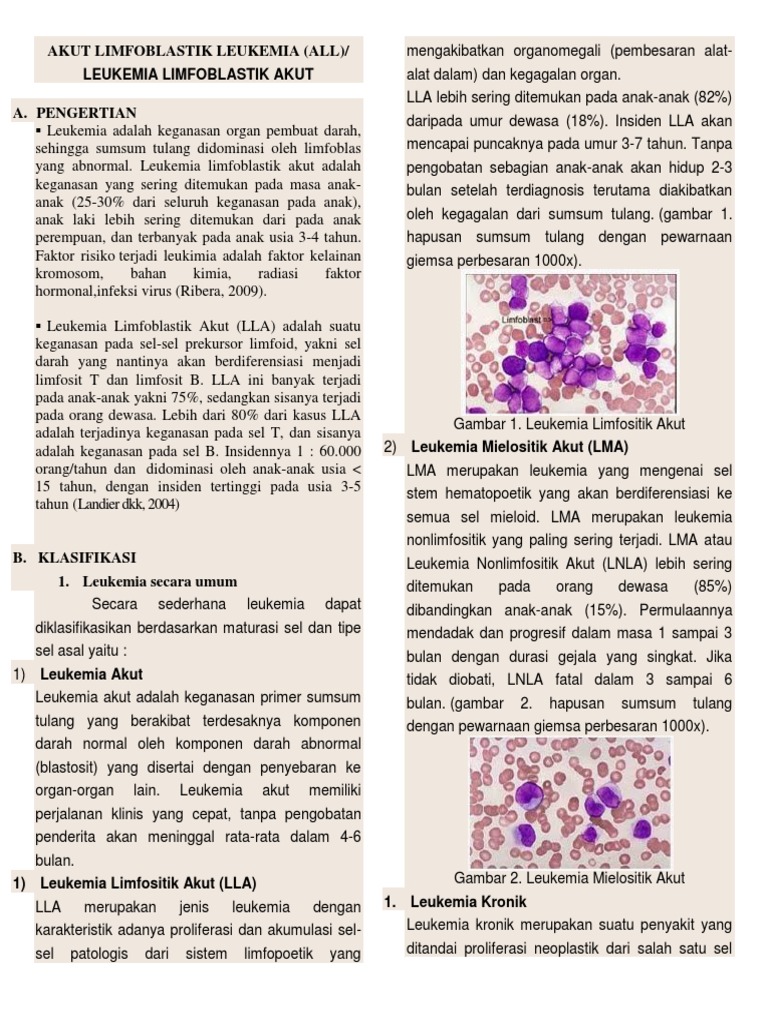 Akut Limfoblastik Leukemia | PDF
