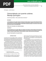 La Onicocriptosis | PDF | Clavo (anatomía) | Dedo del pie