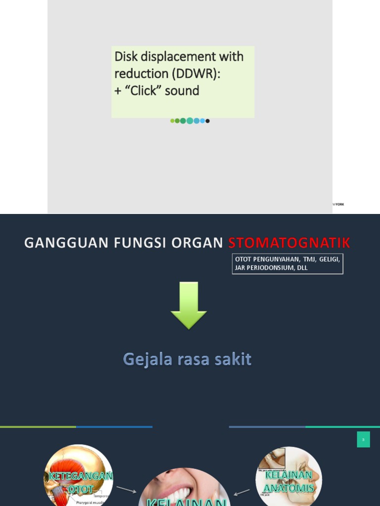 Disc Displacement With Reduction (DDWR) | PDF