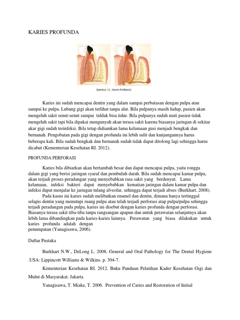 Karies Profunda | PDF