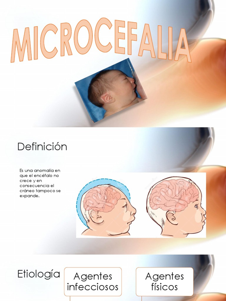 Definición y causas de microcefalia | PDF | Herpes Simple | Virus