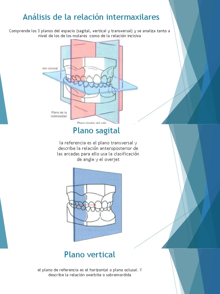 Analisis de Modelo | PDF