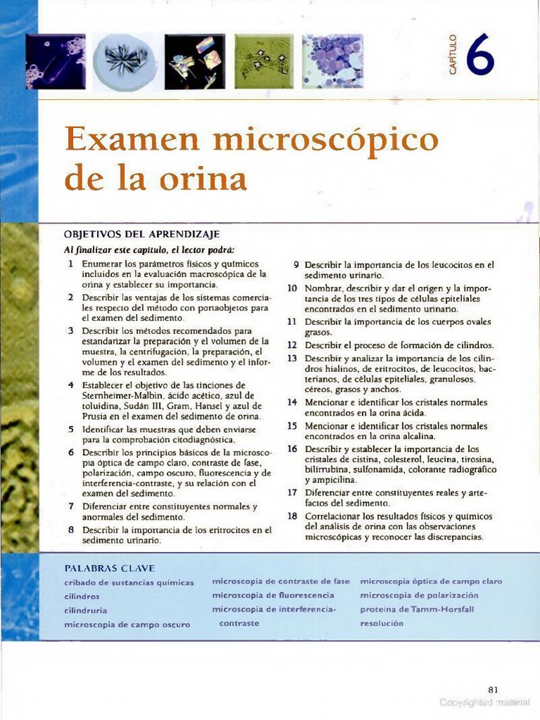 Examen microscópico de la orina: Objetivos Del Aprendizaje | Tinción ...