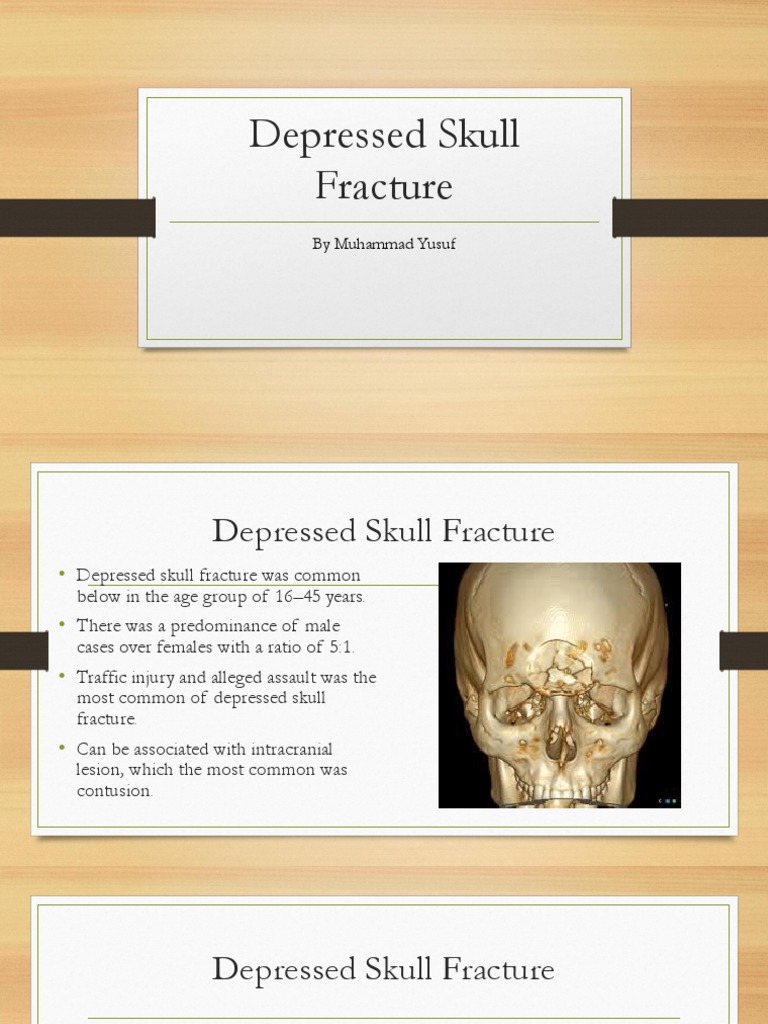 Depressed Skull Fracture | PDF | Surgery | Wound